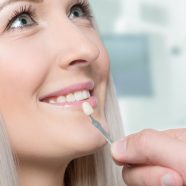 Porcelain Dental Veneers | Treatment, Recovery & Cost (Updated 2019)