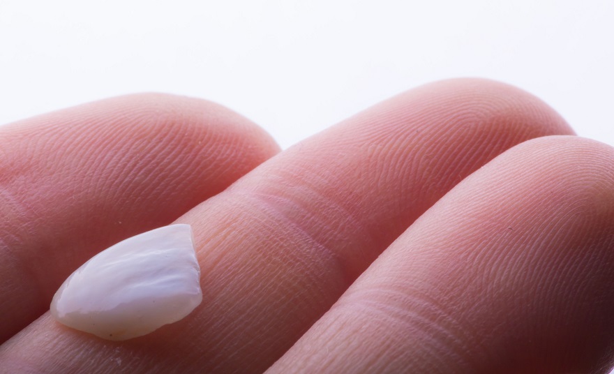 Instant Cosmetic Smile Enhancement with Componeers | Ask the Expert